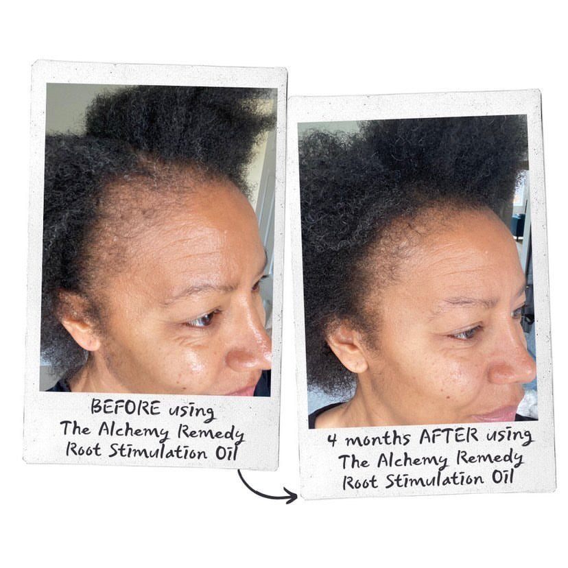 How Does Hair Grow? Root Stimulation Oil Success Stories – The Alchemy ...